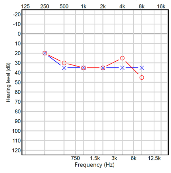 2.1. Describing deafness - BATOD